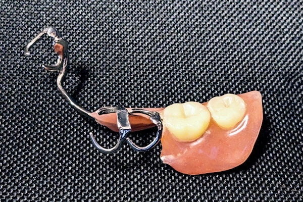 40万円の入れ歯を作った老人が半月後に亡くなった話を聞いて前者後者の解釈 | COROBUZZ